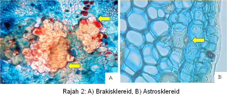 Sel Sklerenkima: Sel Kuat dalam Tumbuhan | MajalahSains